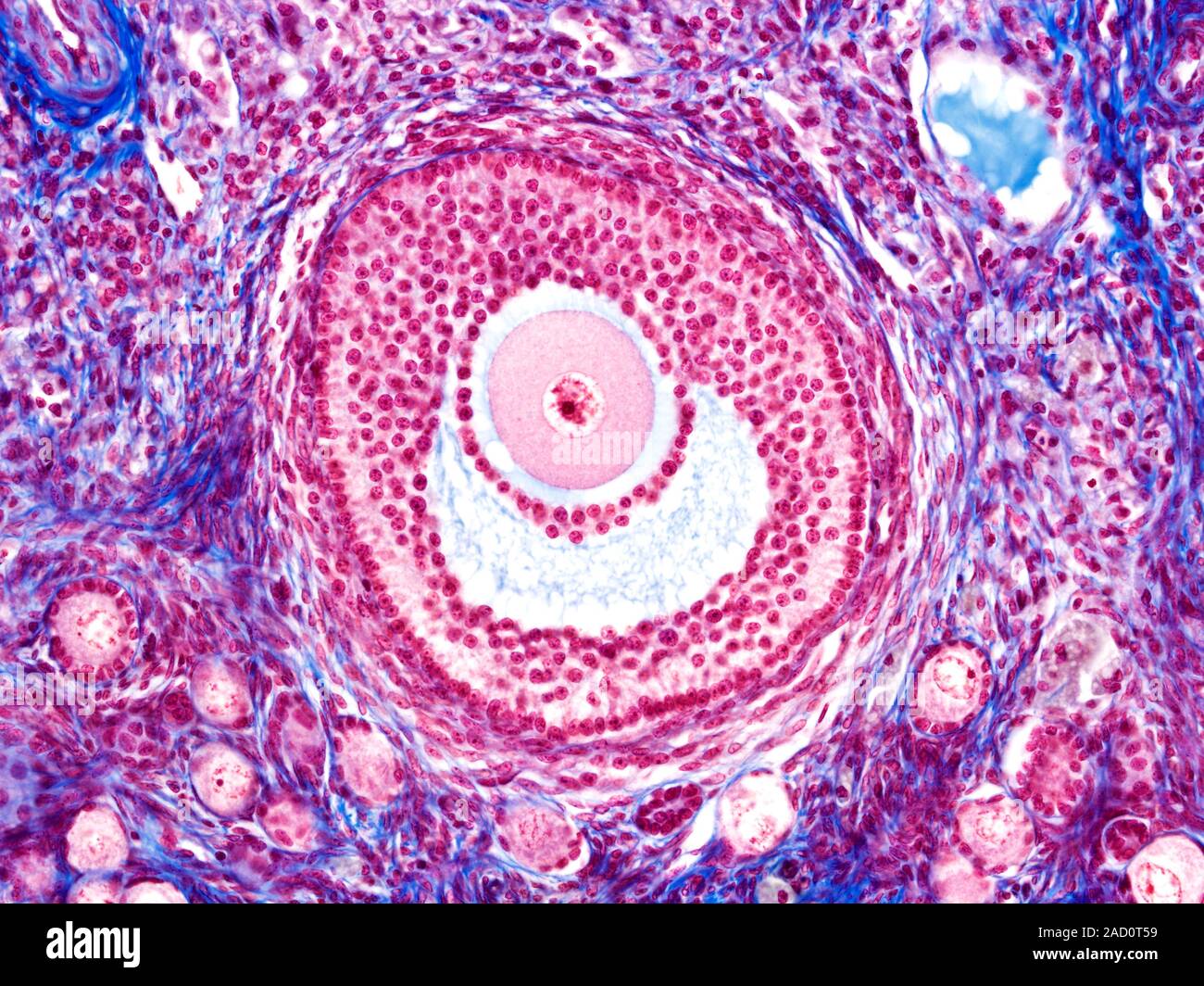 Light microscopy of a growing ovarian follicle at the antral or ...