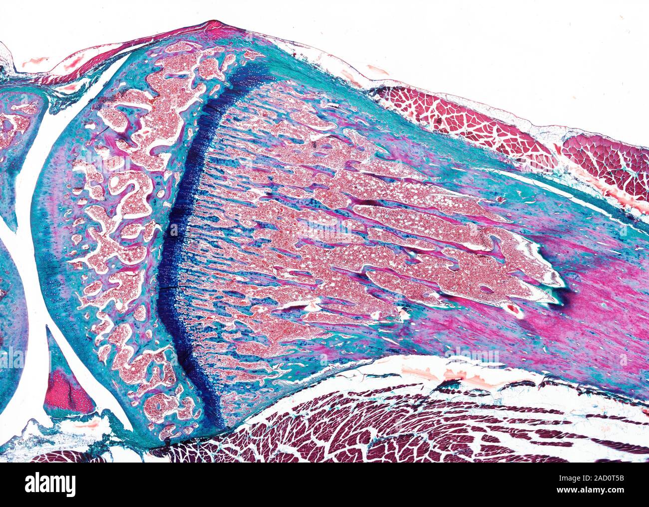 Light microscopy of a growing long bone. The dark blue staining band is ...