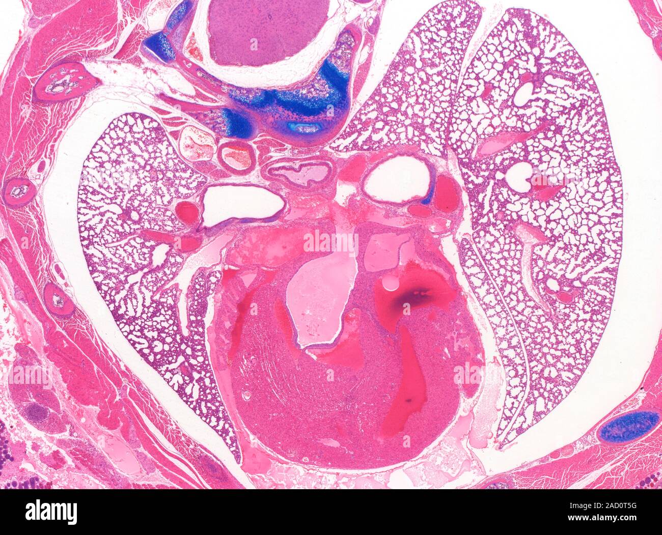 Light microscopy of a cross-section of the thorax of the fetal rat ...