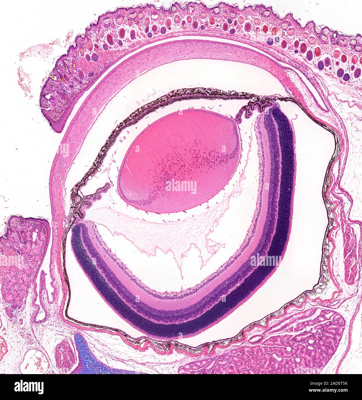 Light microscopy of a section through the developing eye of a fetus ...