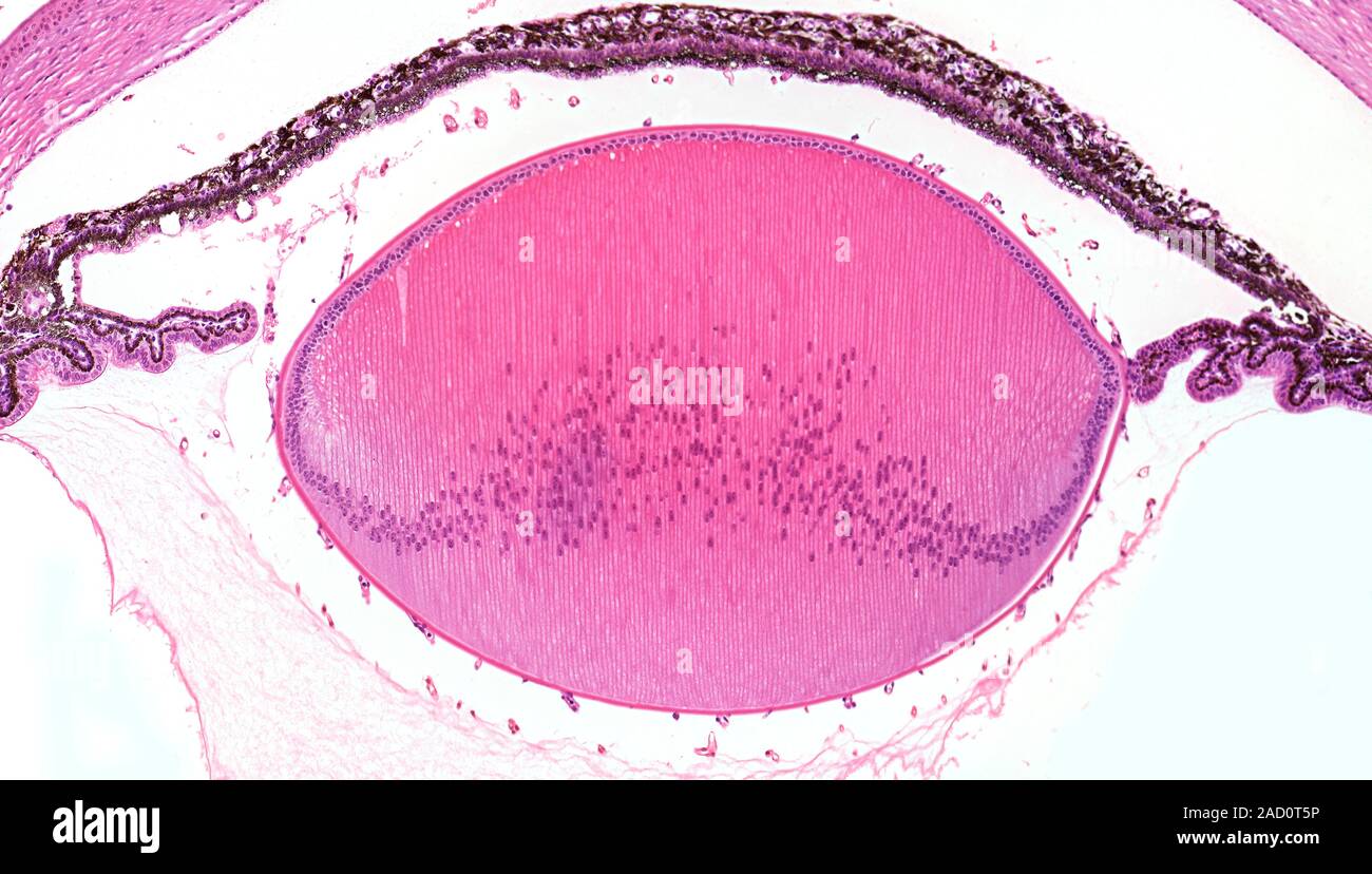 Light microscopy of a section through the lens from the eye of a ...