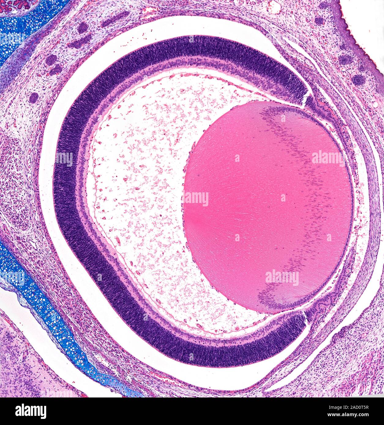Light micrograph of a section through an eye from a developing fetus ...