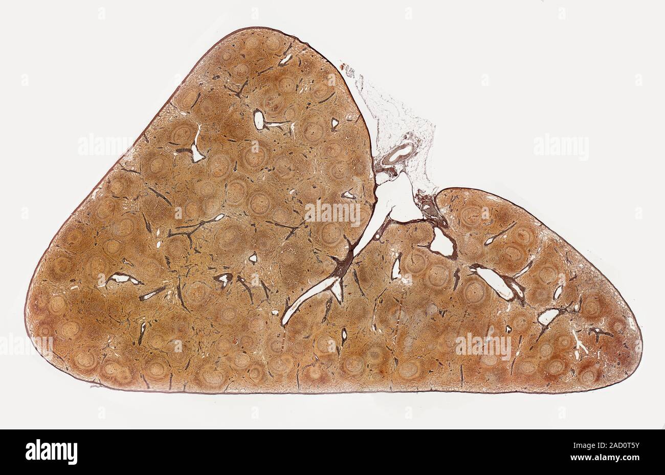 Light microscopy of the spleen, showing the internal structure using ...
