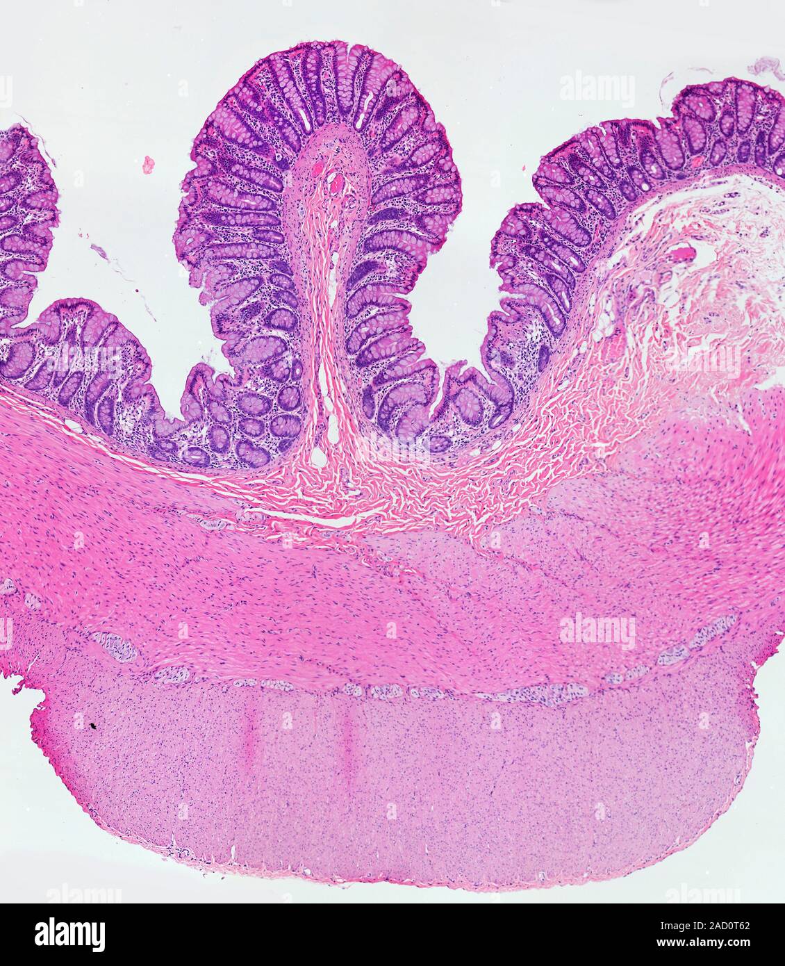 Light microscopy of the large bowel (colon) showing its internal ...