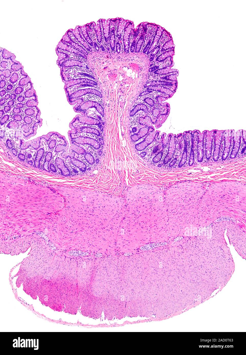 Light microscopy of the large bowel (colon) showing its internal ...