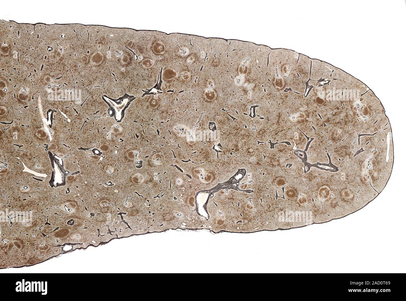 Light microscopy of the spleen, showing the internal structure using ...