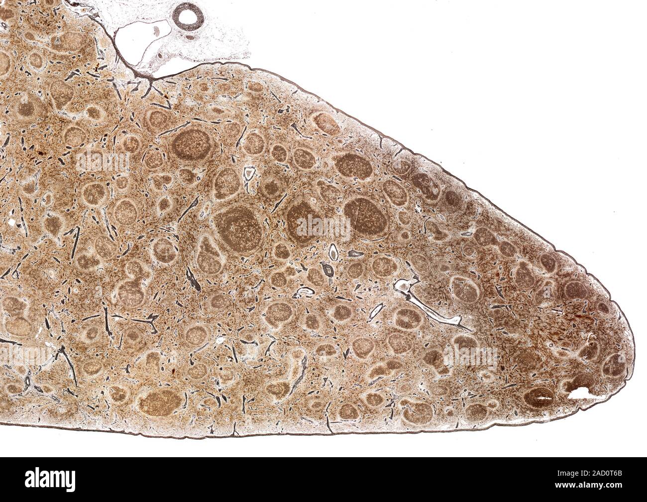 Light microscopy of the spleen, showing the internal structure using ...