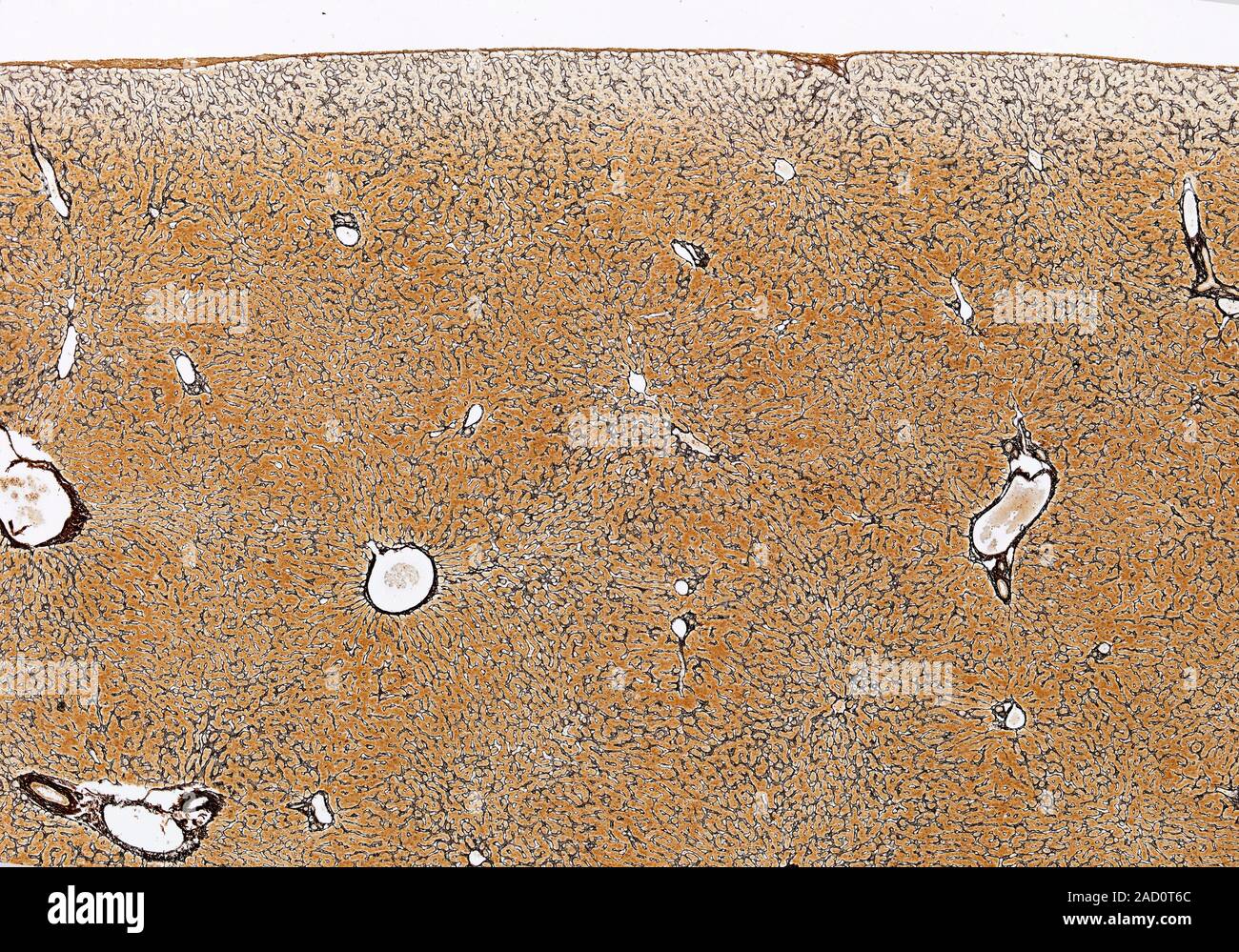 Light microscopy of liver tissue using the reticulin stain whereby ...