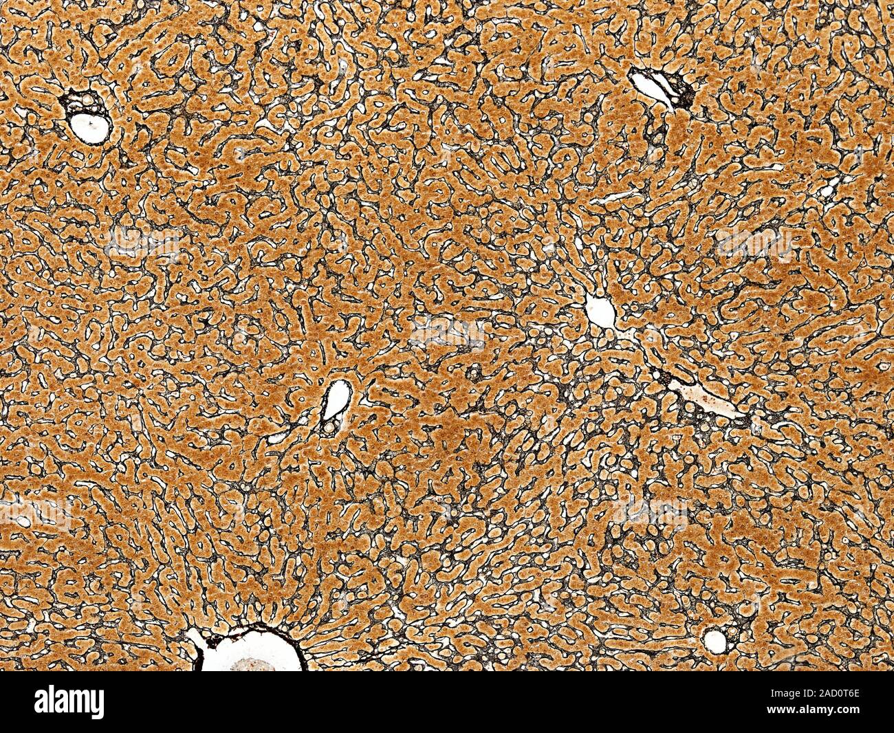 Light microscopy of liver tissue using the reticulin stain whereby ...