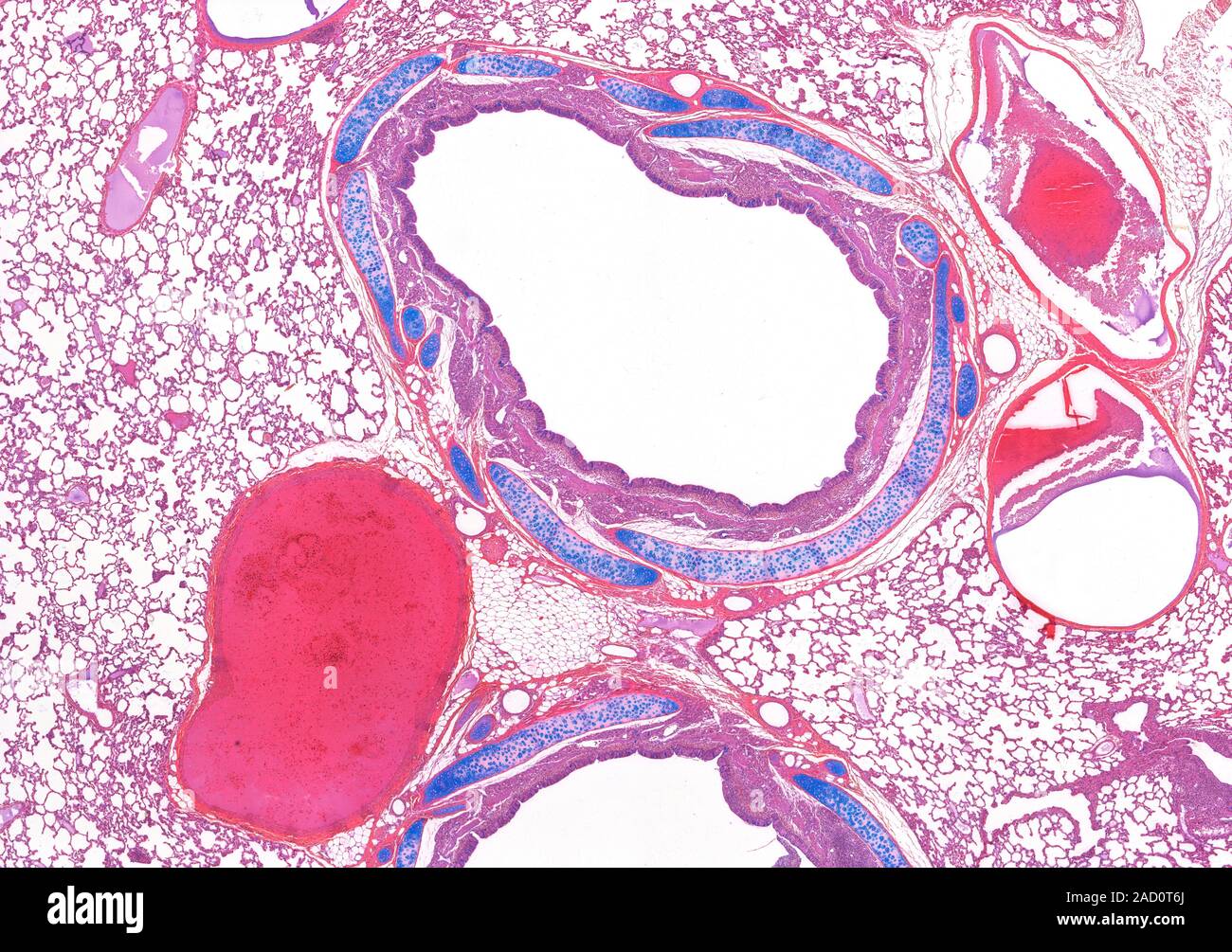 Light microscopy of lung tissue showing a bronchus. As large diameter ...