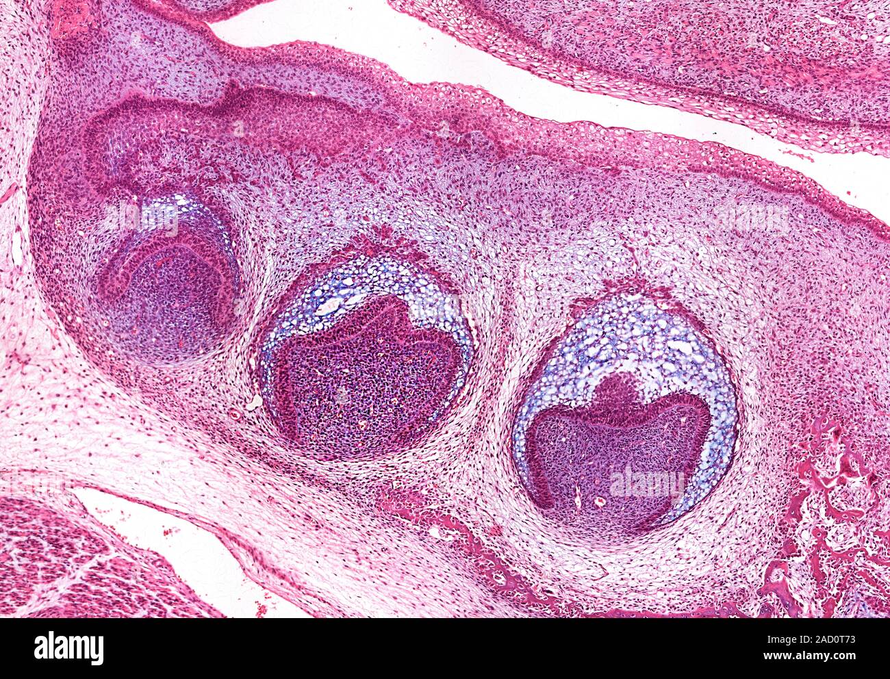 Light microscopy of fetal teeth. Teeth in part grow from the surface ...