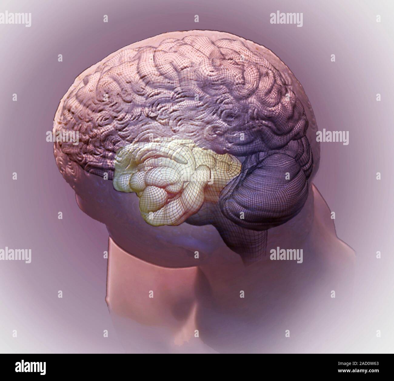 Brain and hippocampus. Coloured 3D computed tomography (CT) scan of the ...