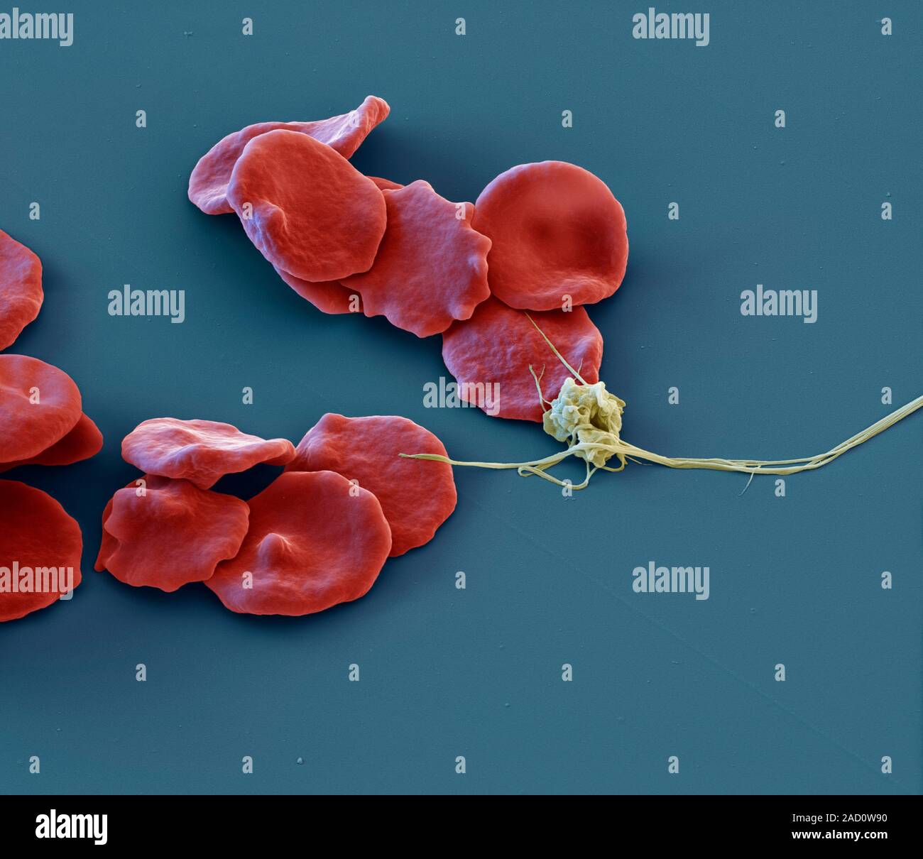 Blood cells. Coloured scanning electron micrograph (SEM) of red blood ...