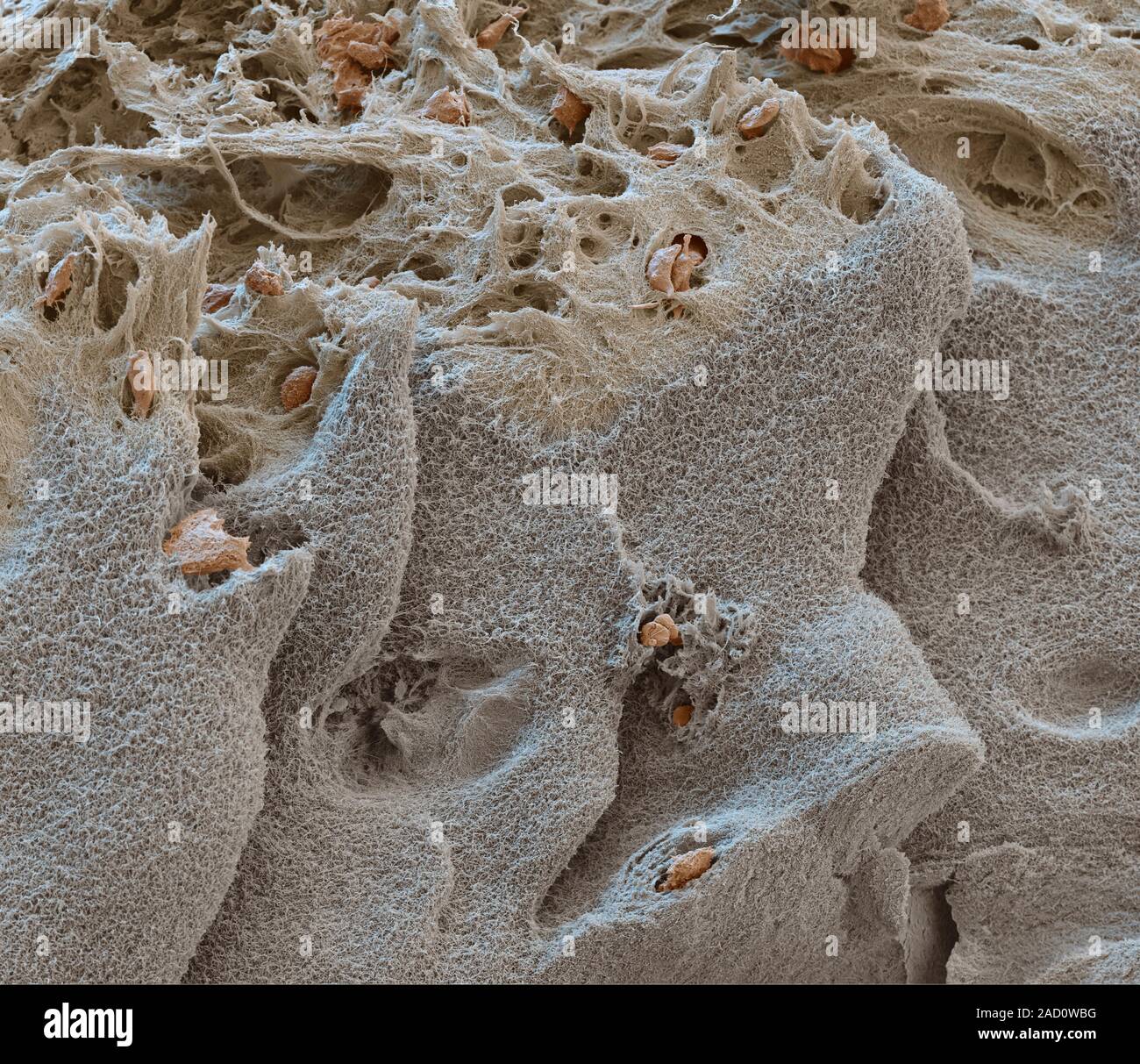 Cartilage. Coloured scanning electron micrograph of a section through cartilage tissue, showing ...