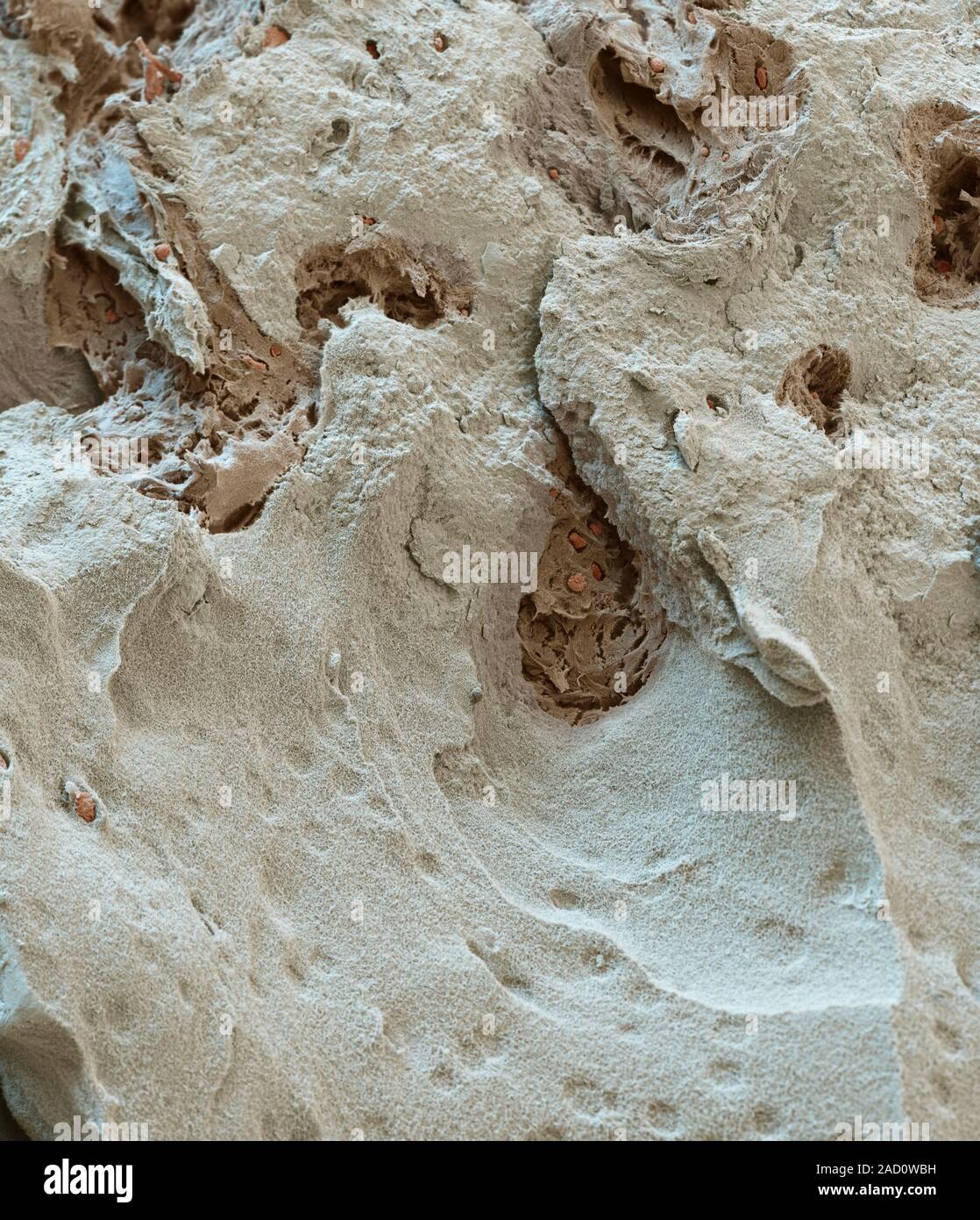 Cartilage. Coloured scanning electron micrograph of a section through cartilage tissue, showing ...