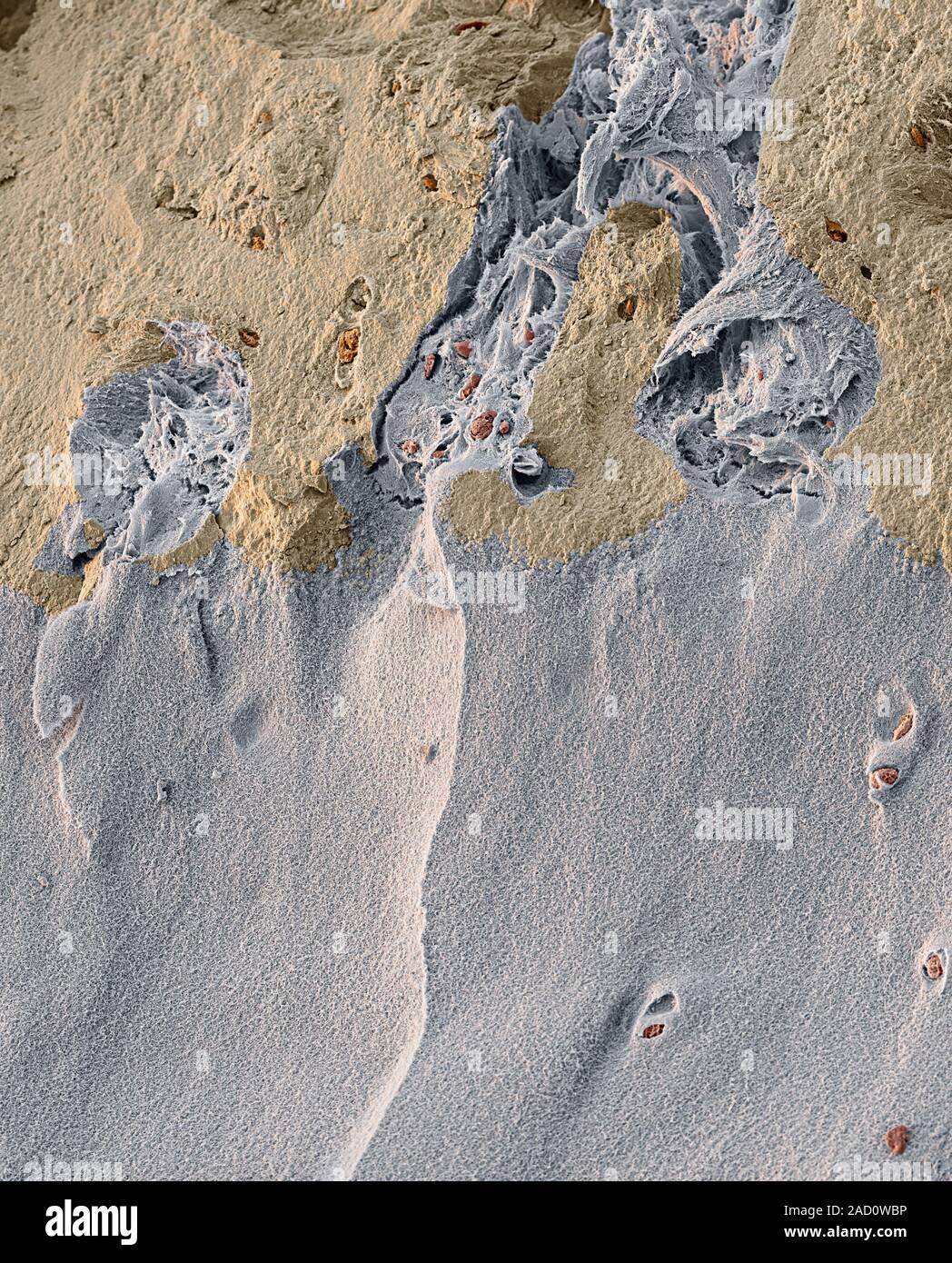 Cartilage. Coloured scanning electron micrograph of a section through cartilage tissue, showing ...