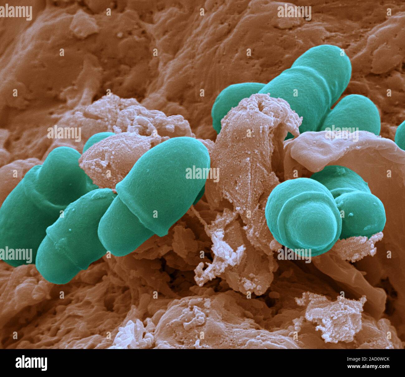 Malassezia skin fungus. Coloured scanning electron micrograph (SEM) of ...