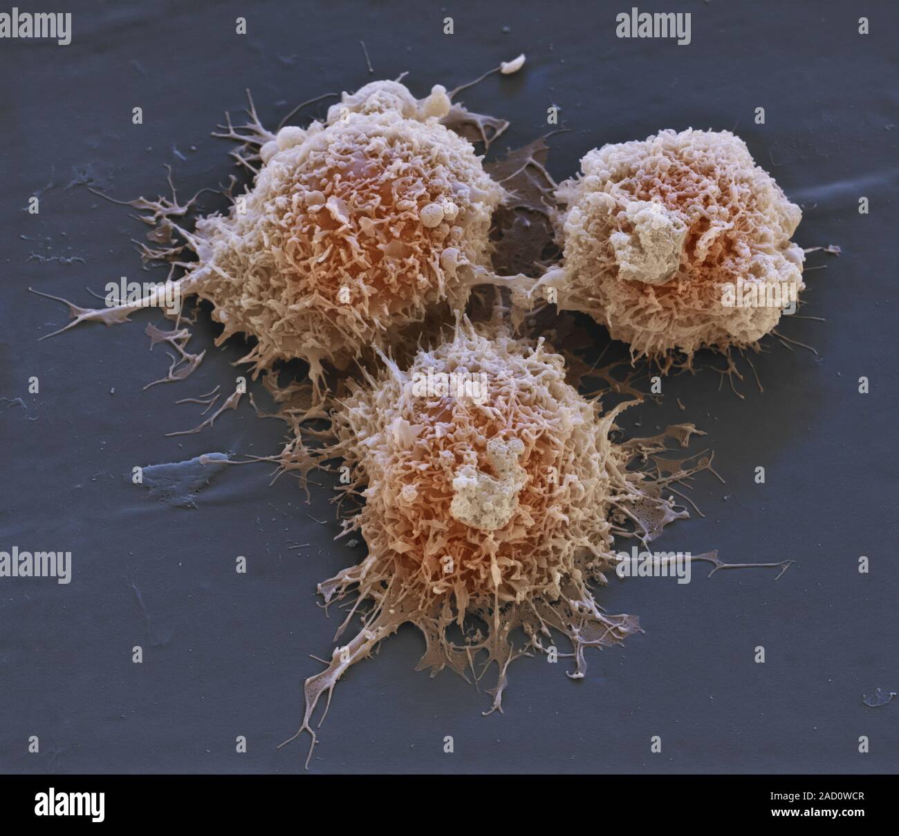 Mast cells, coloured scanning electron micrograph (SEM). Mast cells are ...