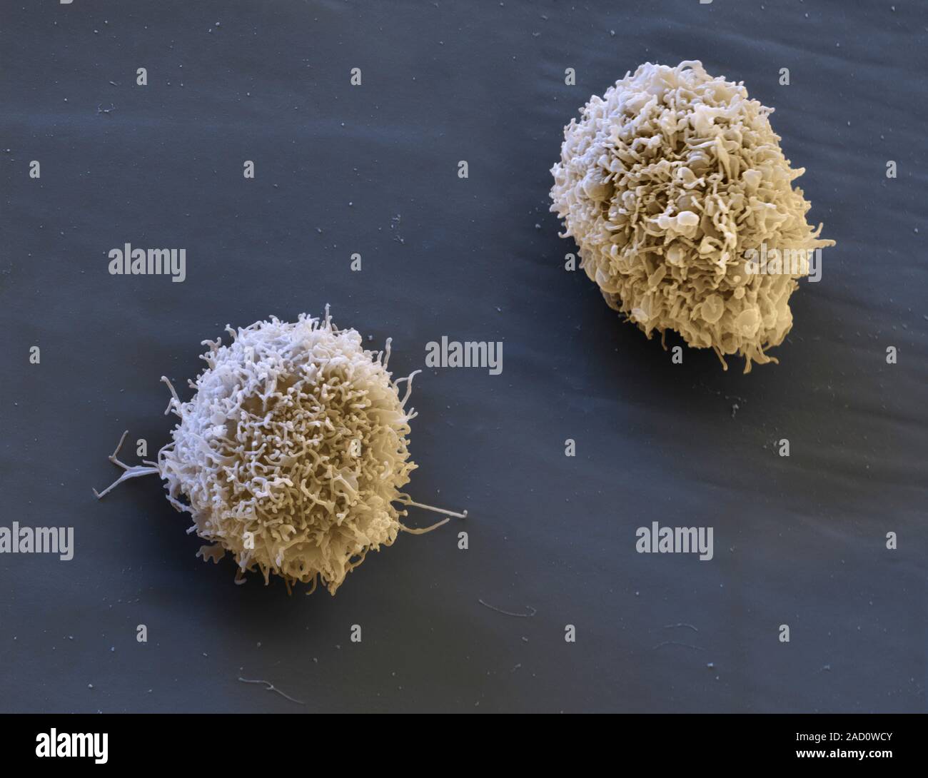 Mast cells, coloured scanning electron micrograph (SEM). Mast cells are ...