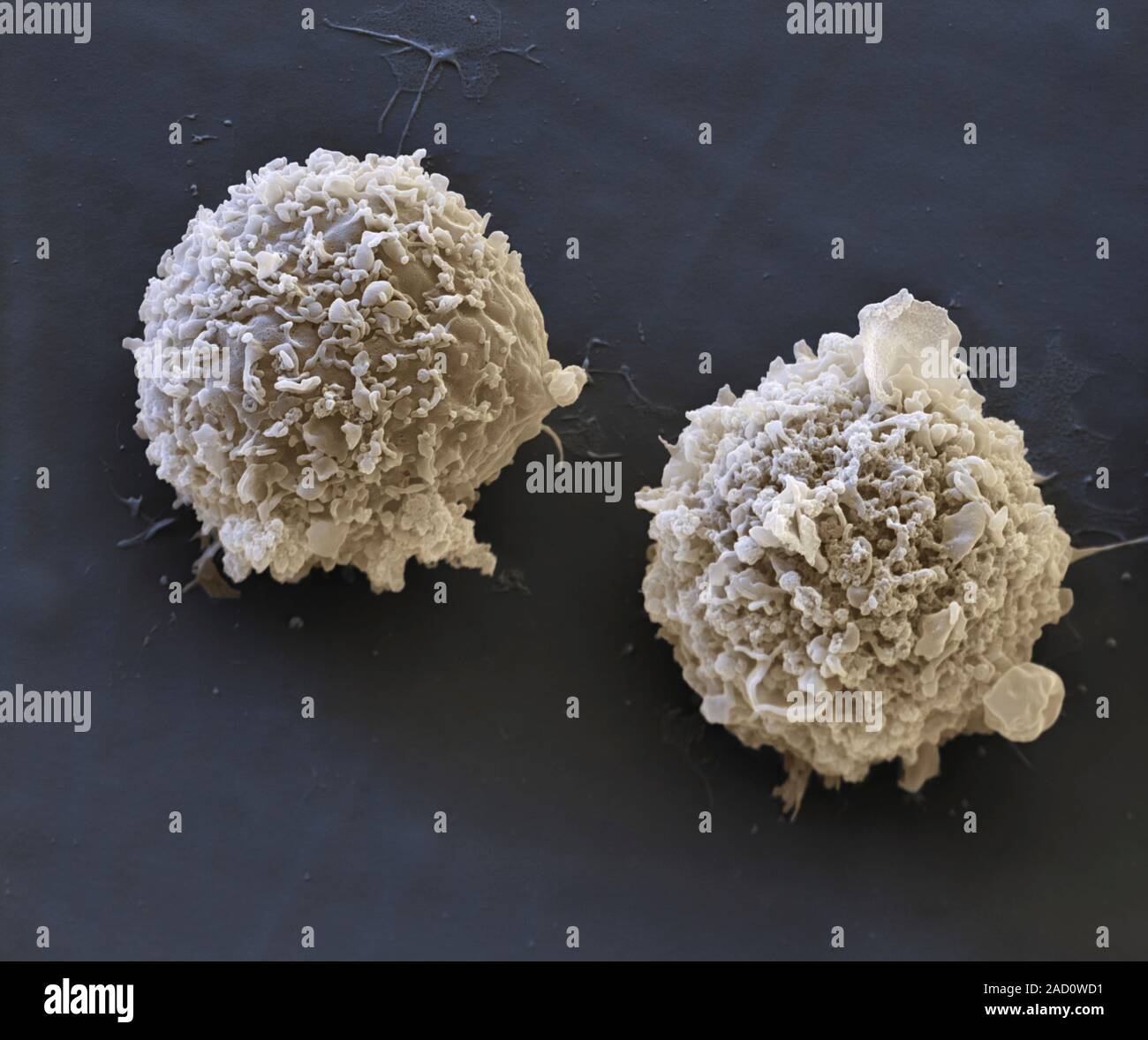 Mast cells, coloured scanning electron micrograph (SEM). Mast cells are ...