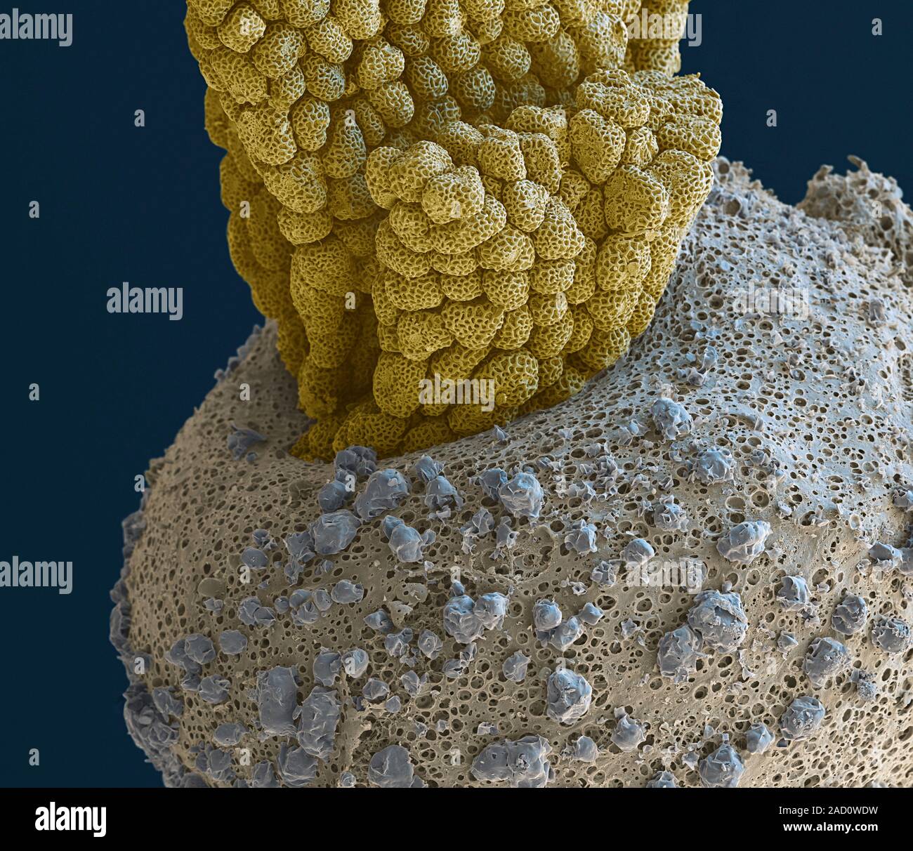 Twayblade orchid pollen. Coloured scanning electron micrograph (SEM) of ...
