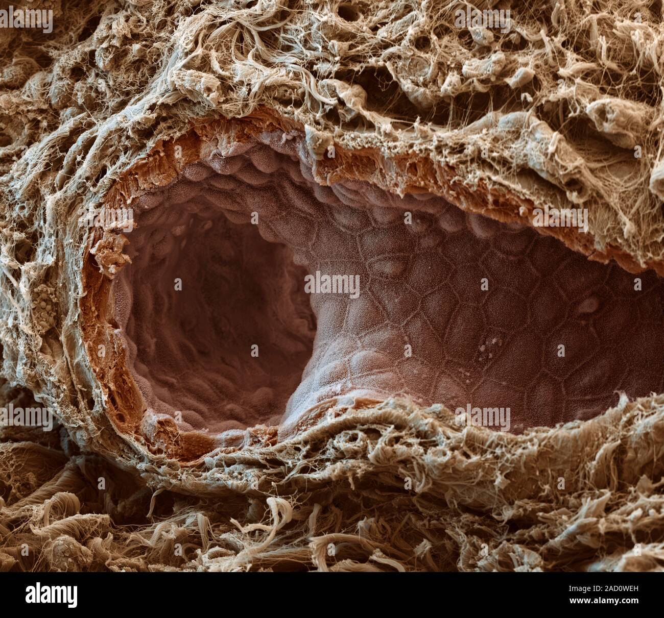 Sweat gland. Coloured scanning electron micrograph (SEM) of a section ...