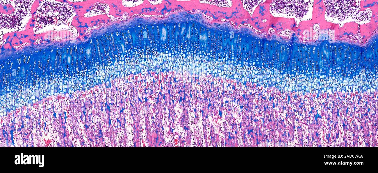 Light microscopy of a growth plate in a growing bone. The growth plate ...