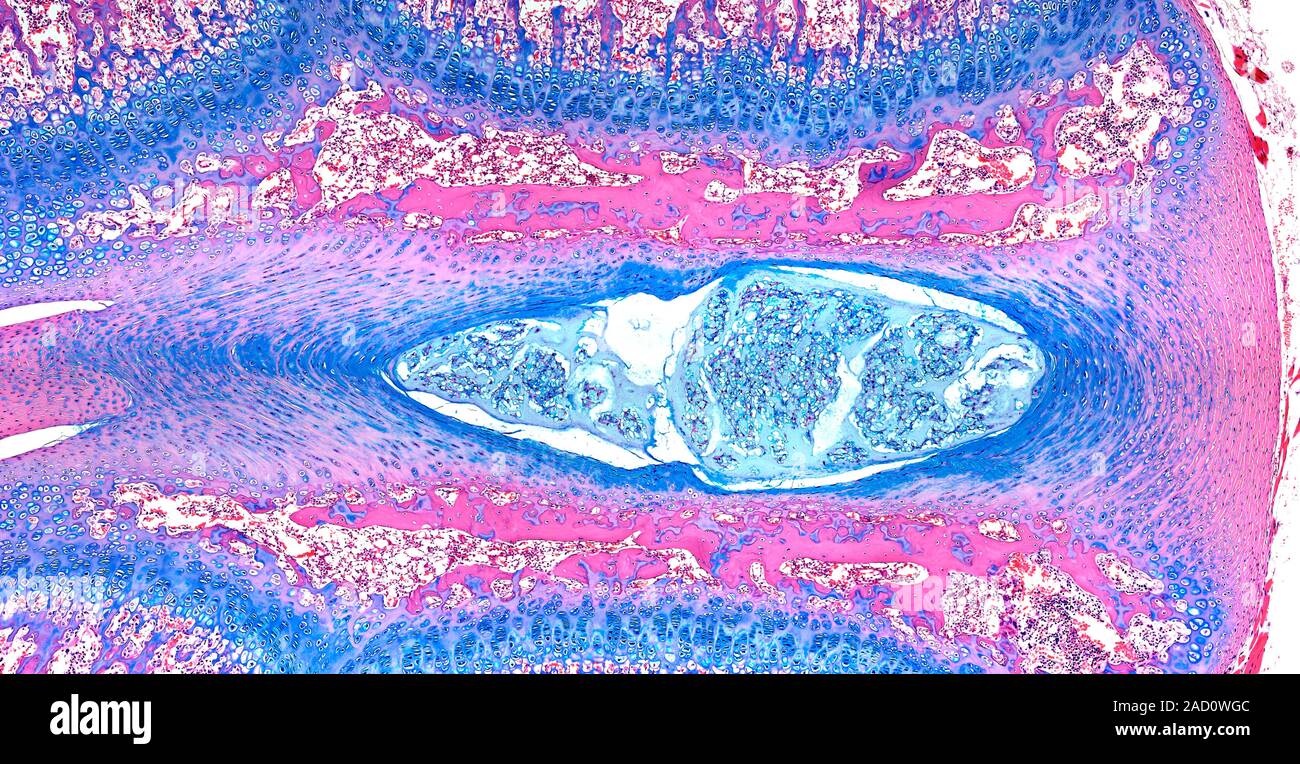 Light microscopy of an intervertebral disc. The disc is found between ...