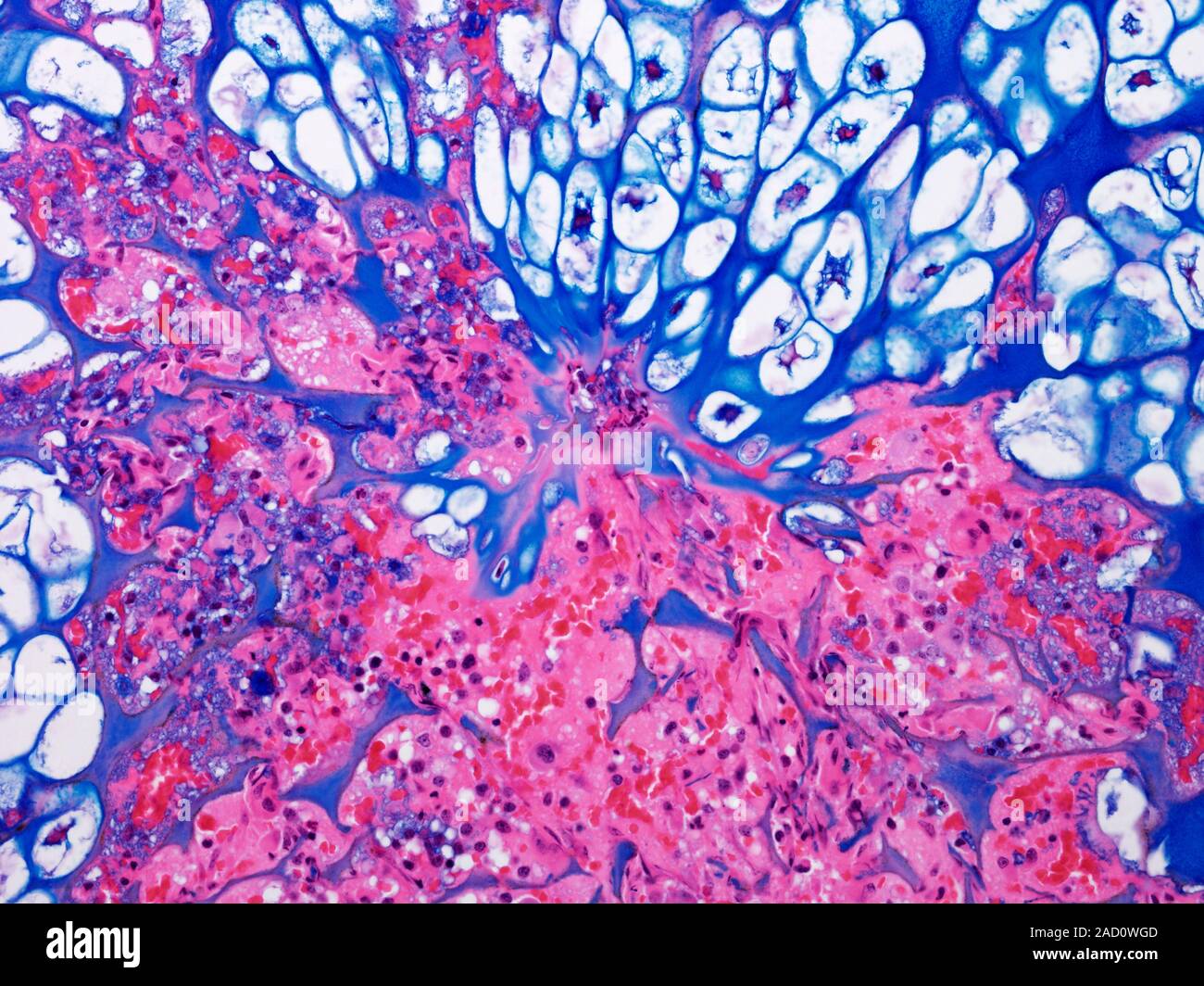 Light microscopy of fetal skeleton showing cartilage (blue) and ...