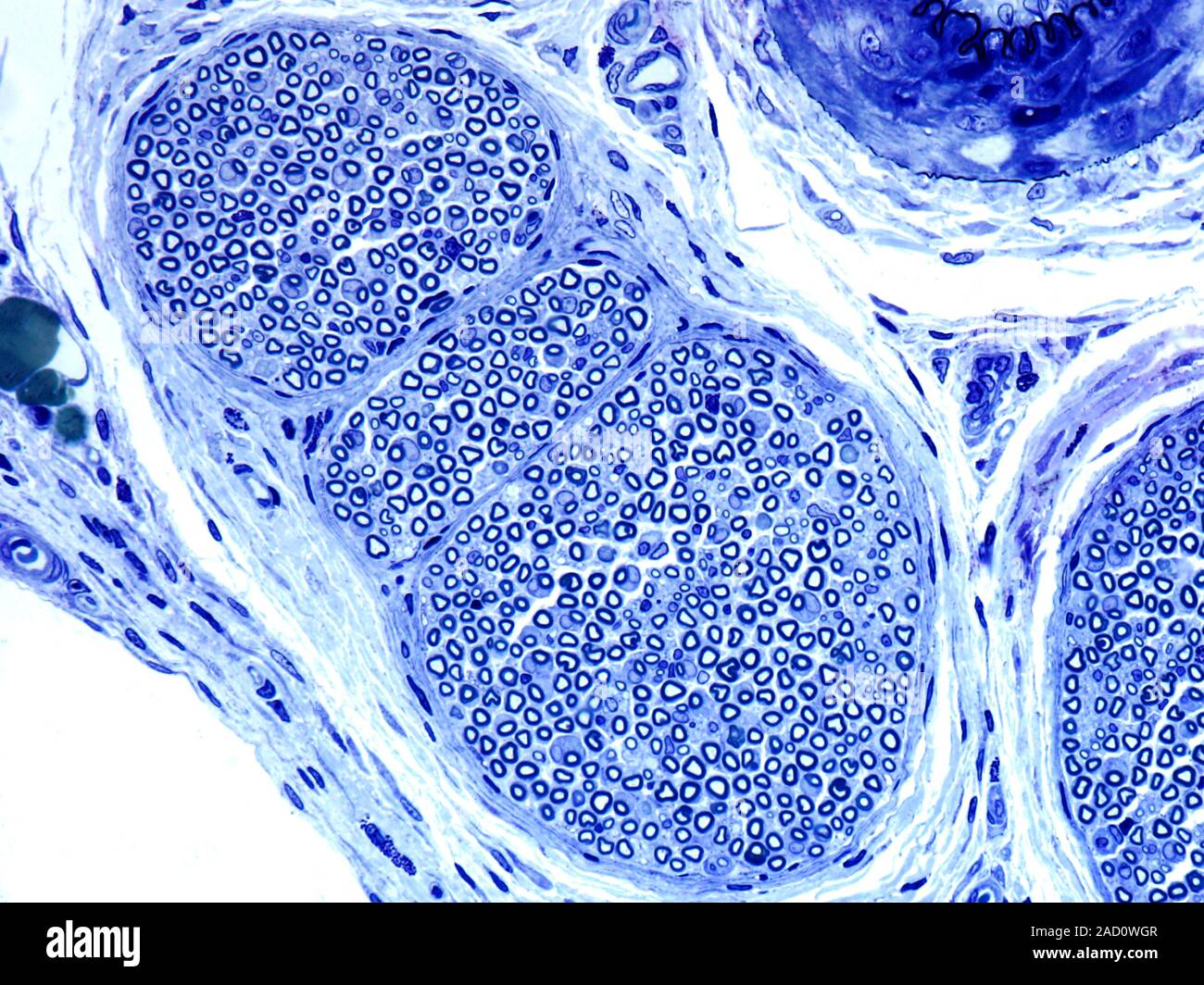 Light microscopy of a cross-section of a peripheral nerve. Nerve fibres ...