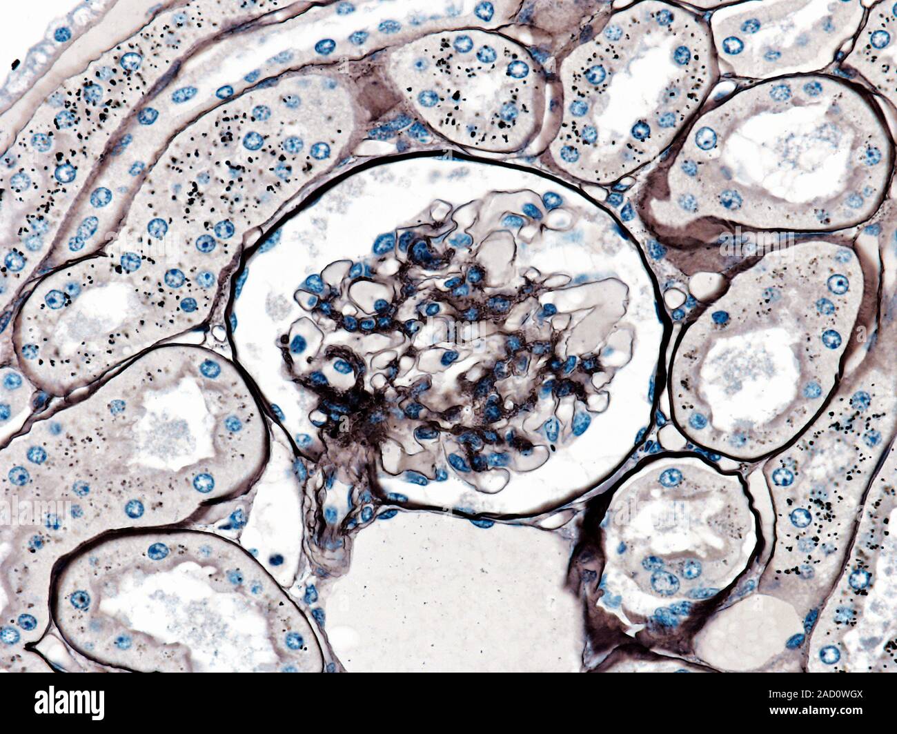 Light microscopy of a glomerulus in the kidney. Glomeruli also known as ...