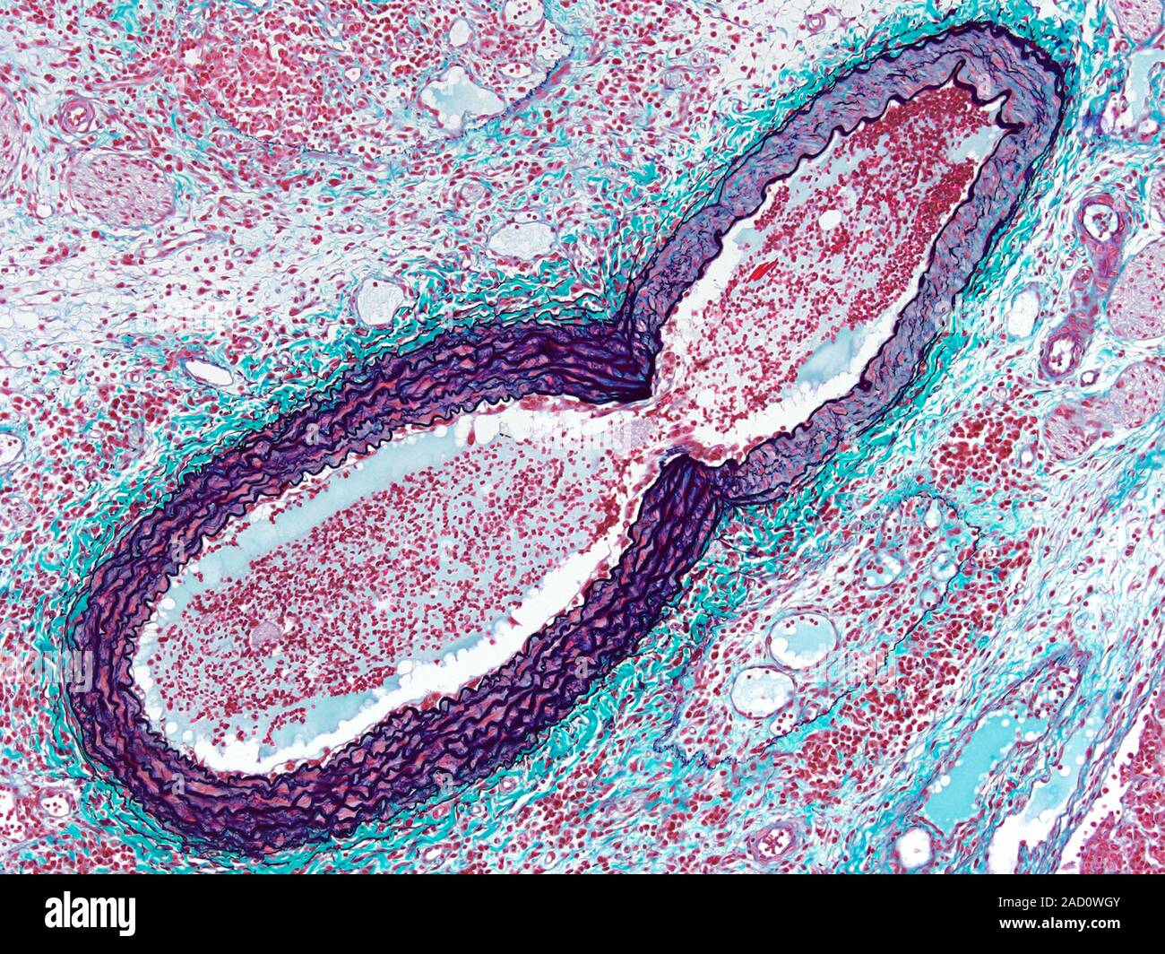 Light microscopy of an elastic- to-muscular artery transition. The ...