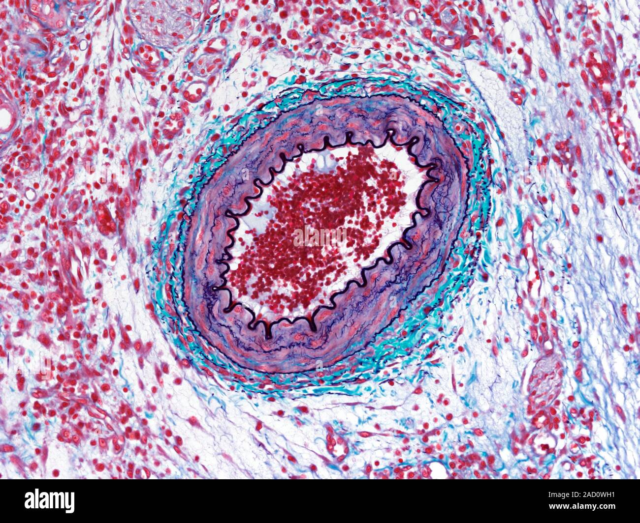 Light microscopy of a muscular artery. This is the most common type ...