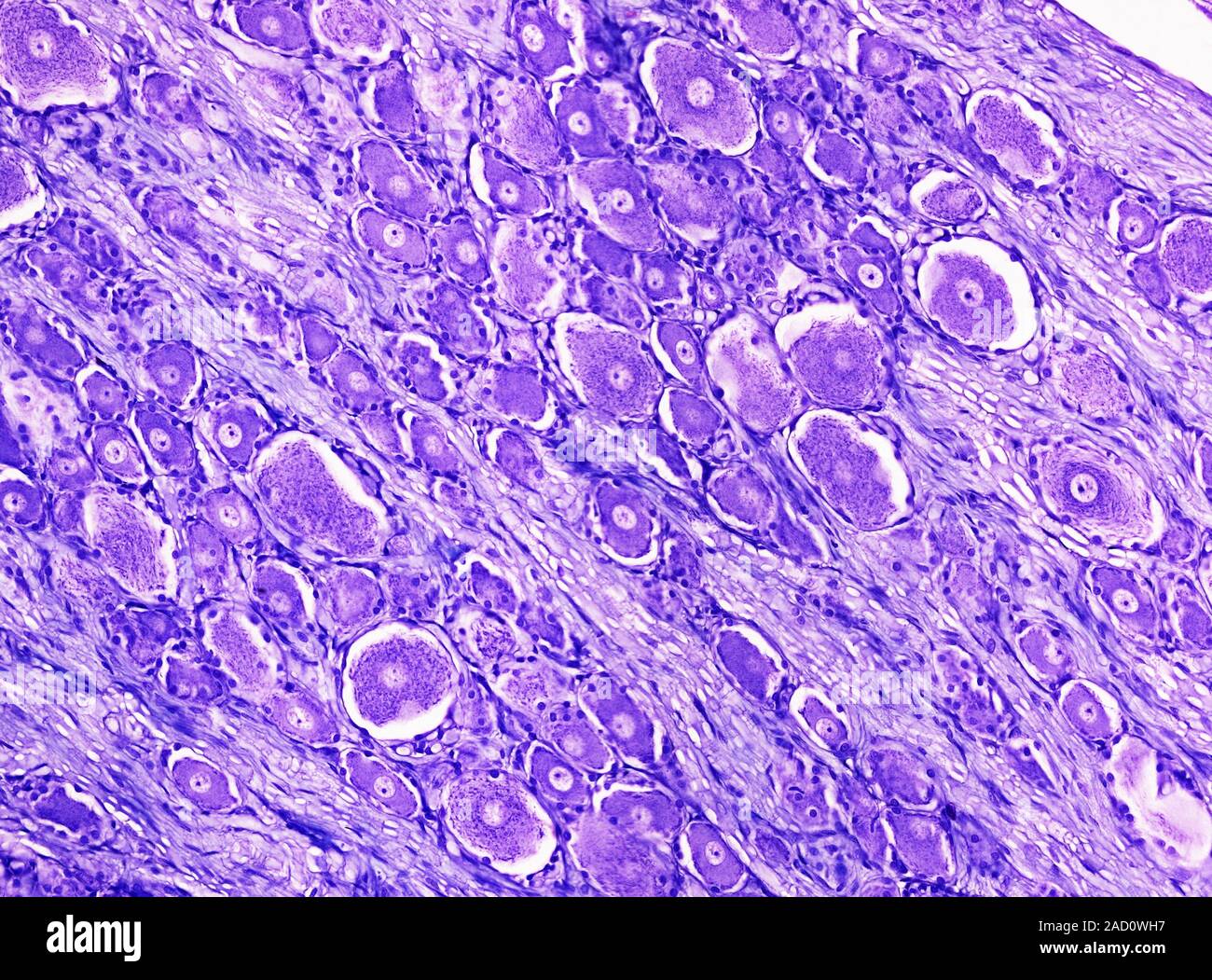 Light microscopy of a spinal sensory ganglion also known as a dorsal ...