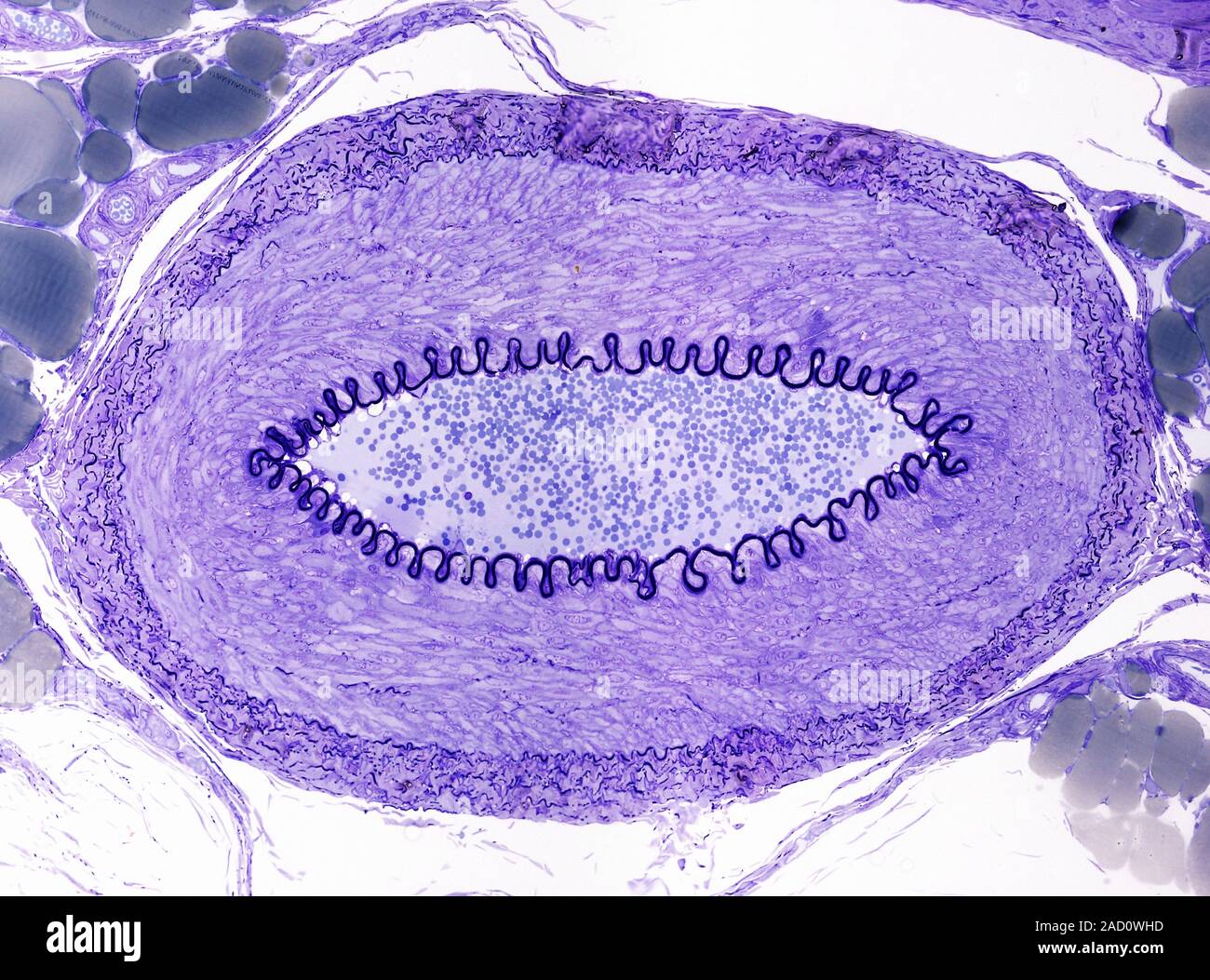 Light microscopy of a muscular artery. This is the most common type ...