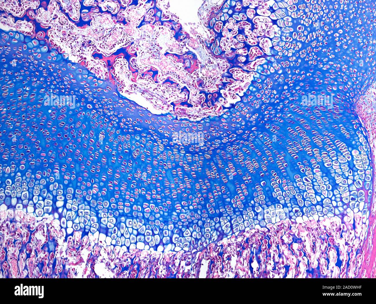 Light microscopy of a growth plate in a growing bone. The growth plate ...