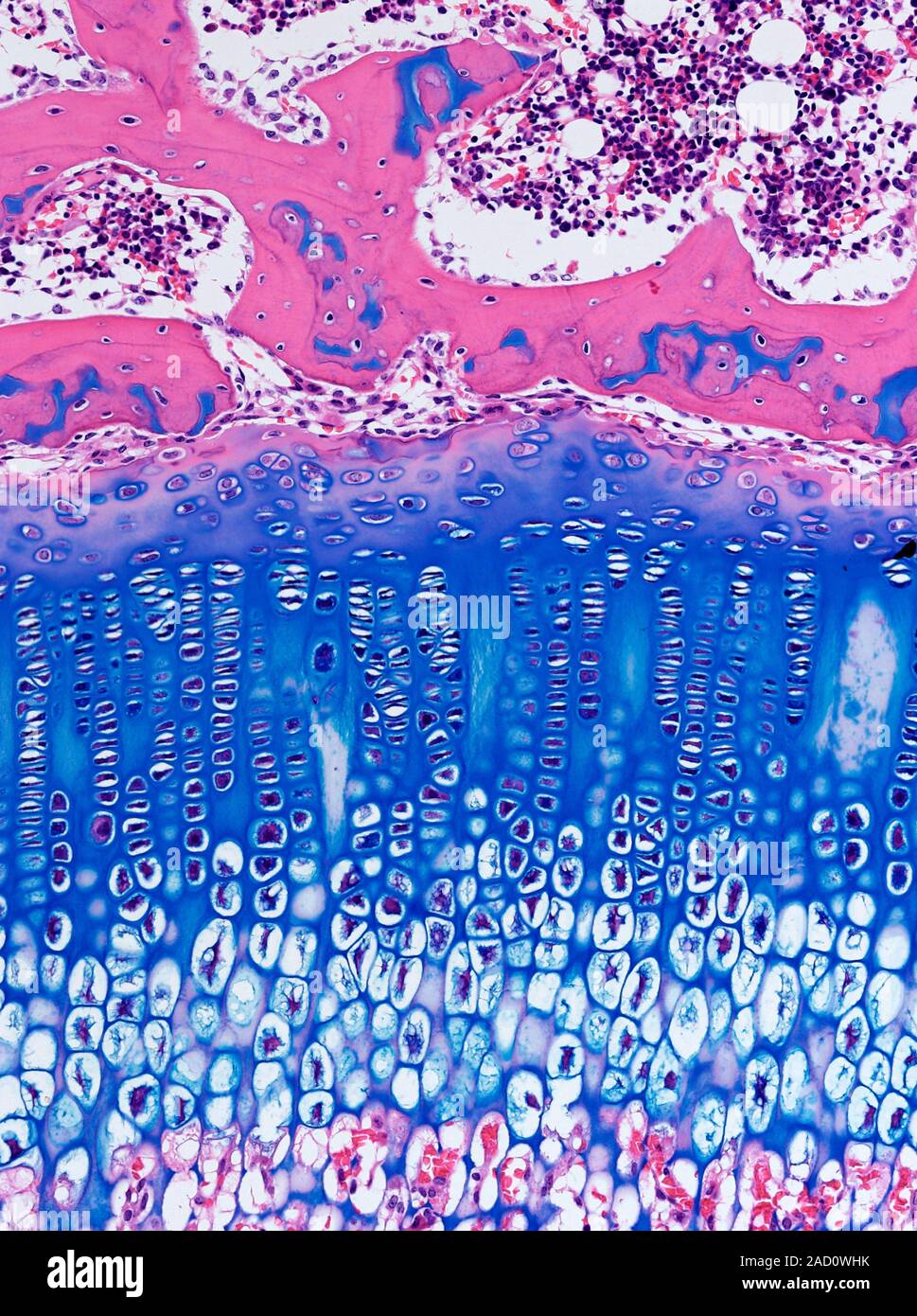 Light microscopy of cellular types of a growth plate in a growing bone ...