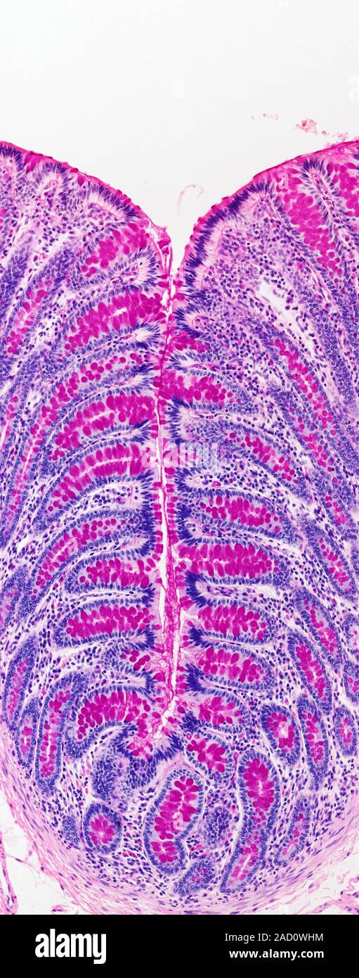 Light microscopy of the inner lining (mucosa) of the large bowel. The ...