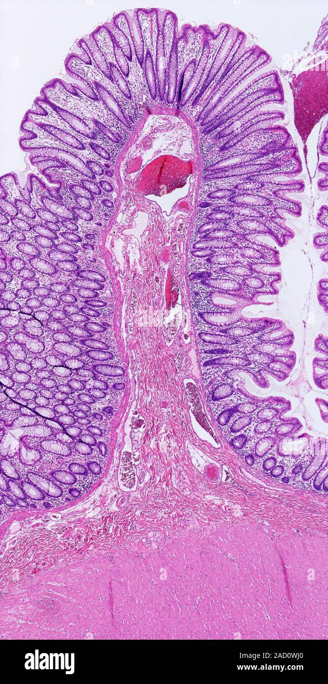 Light microscopy of human normal large bowel mucosa. The mucosa ...