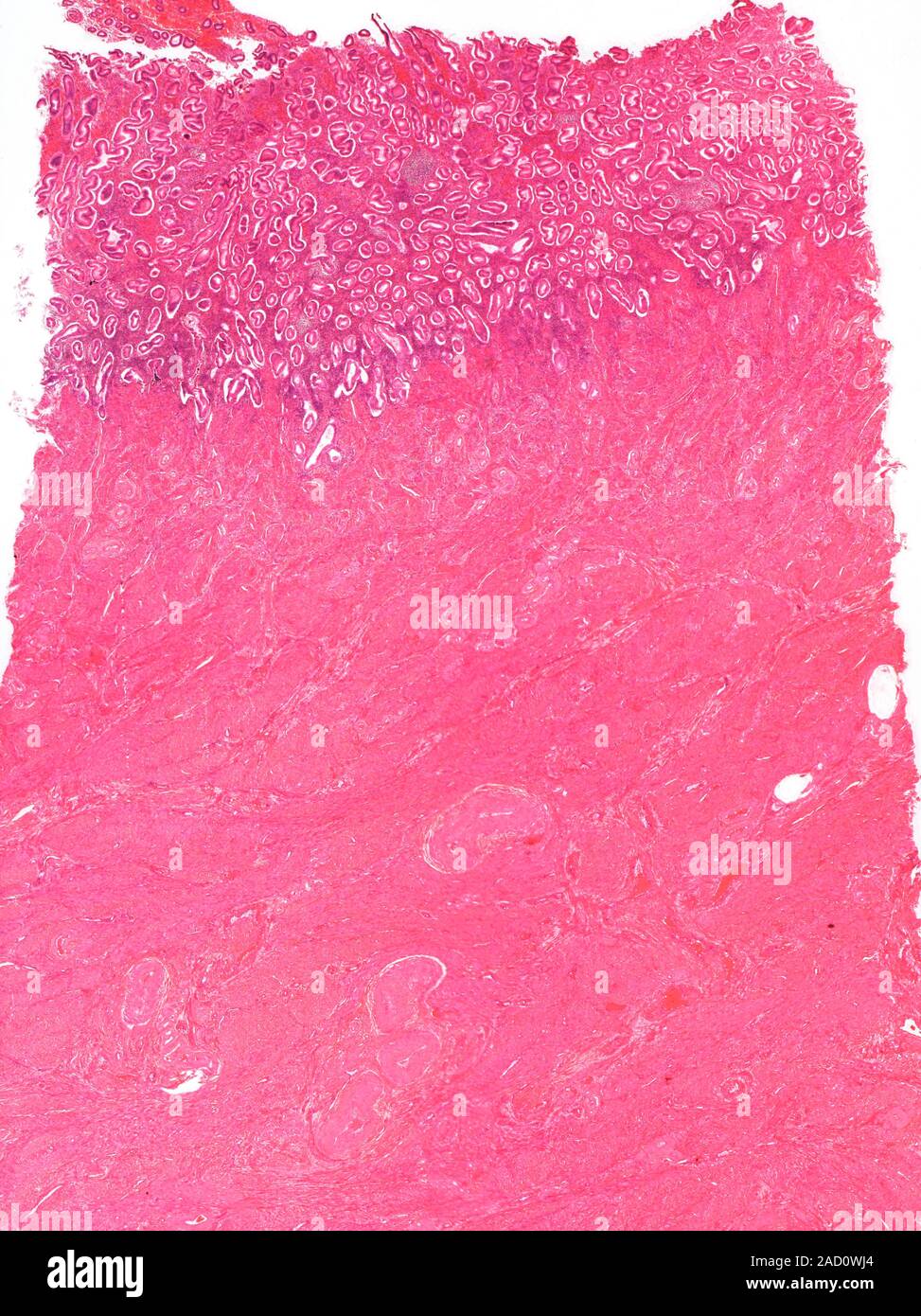 Light micrograph of a section of the human uterus. The inner lining of ...