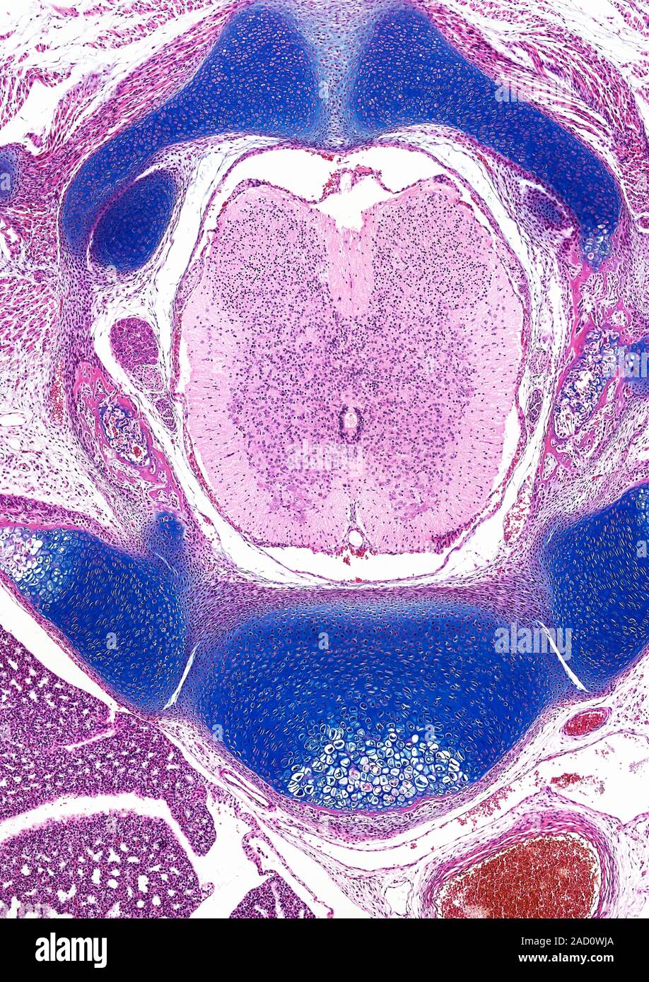 Light microscopy of a cross-section of the fetal spine. Centrally is ...