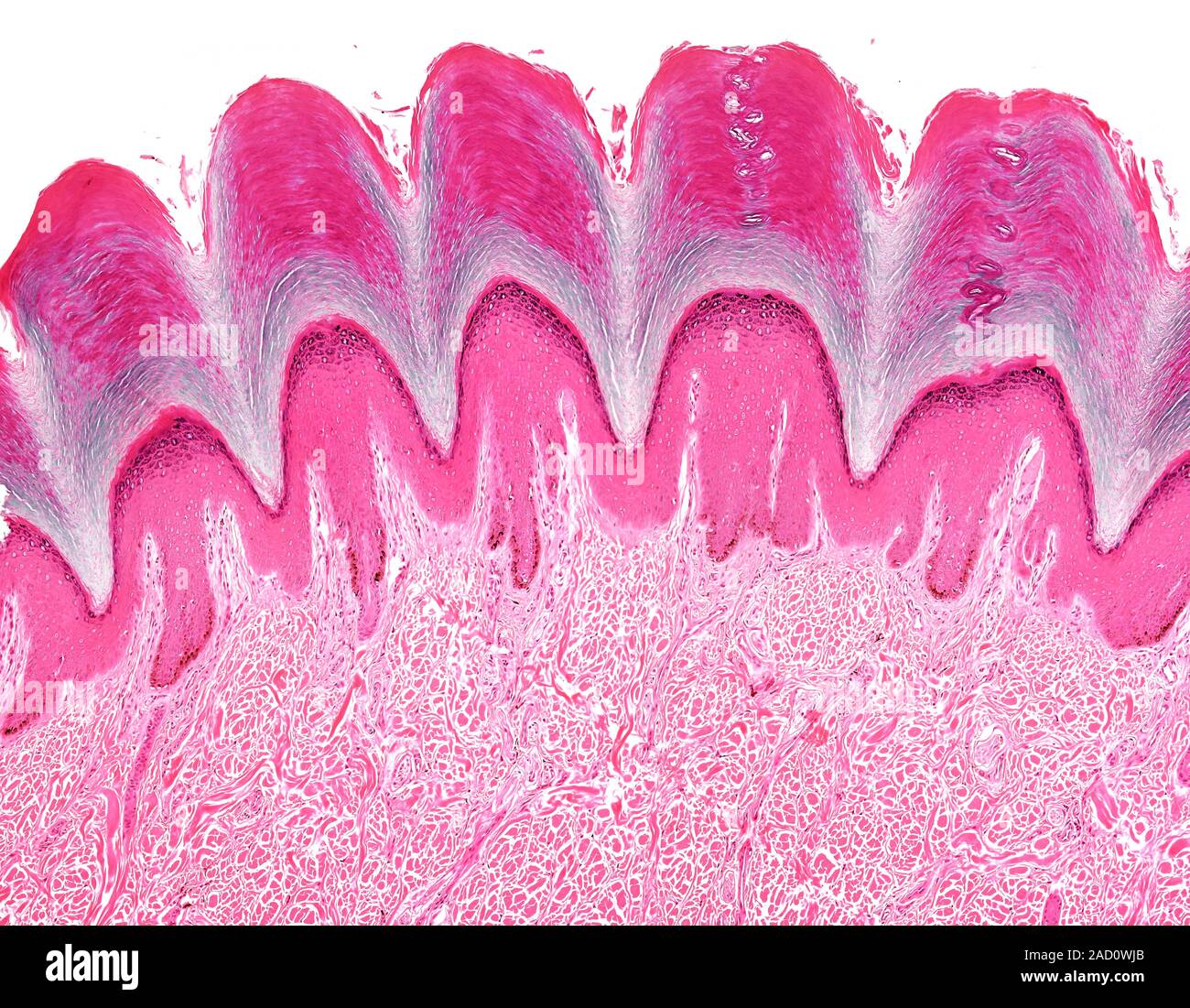 Light microscopy of thick skin. The superficial layer of skin is the ...