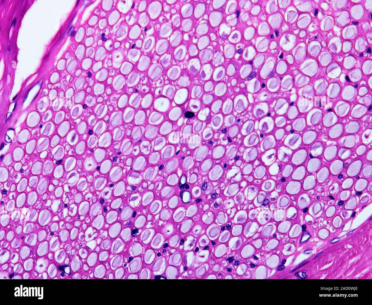 Light microscopy of myelinated nerves in a cross-sectioned nerve fibre ...