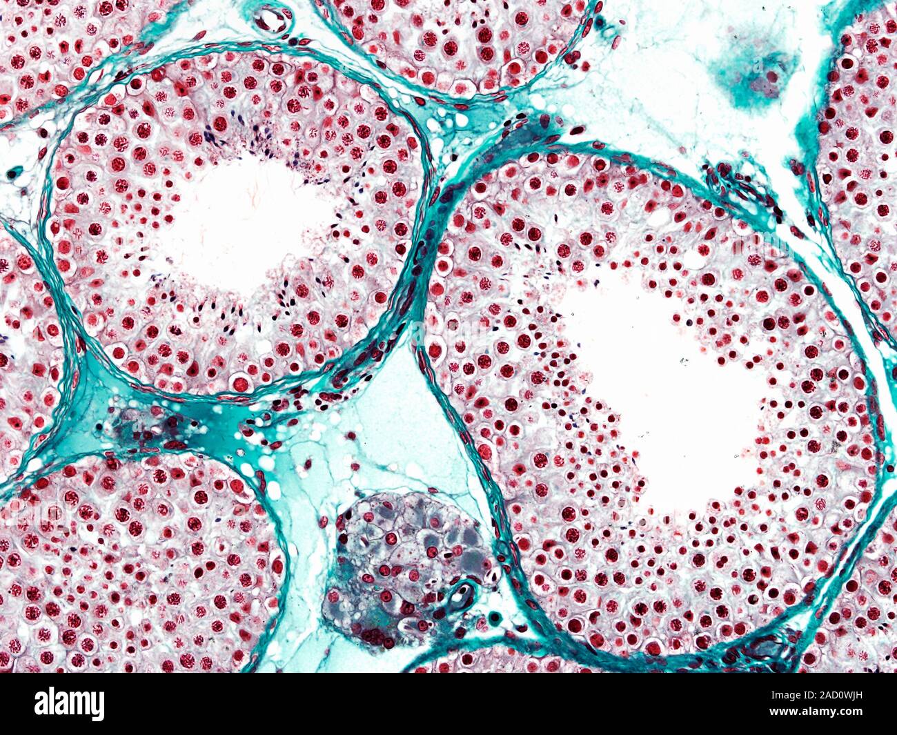 Light microscopy of the human testis. Seminiferous tubules are shown in ...