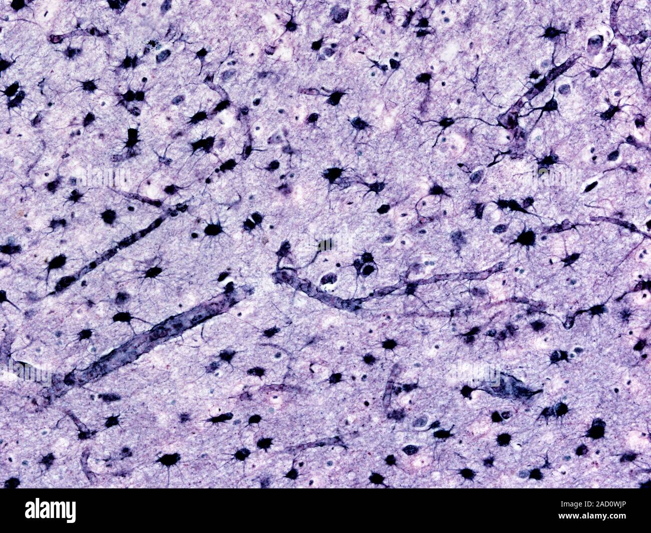 Light microscopy of brain tissue. The gray matter of the cerebral ...