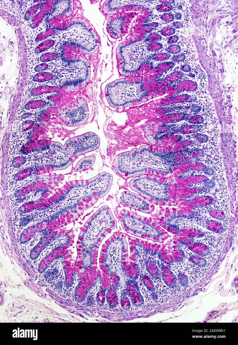 Light microscopy of the inner lining (mucosa) of the small bowel. The ...