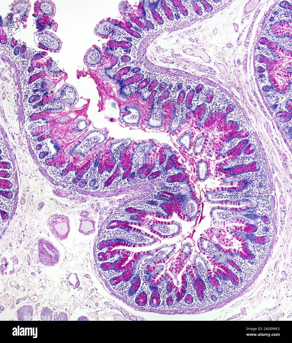Light microscopy of the inner lining (mucosa) of the small bowel. The ...