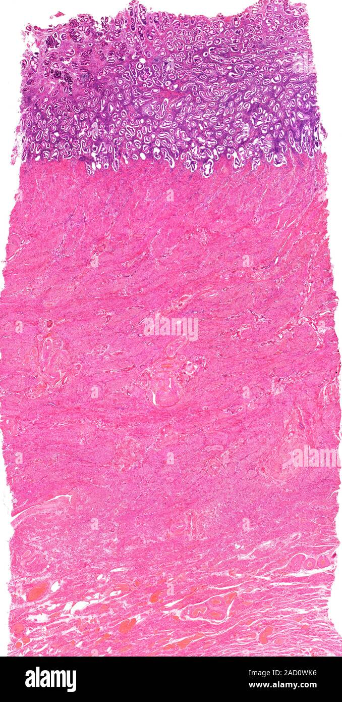 Light micrograph of a section of the human uterus about day 18 of the ...