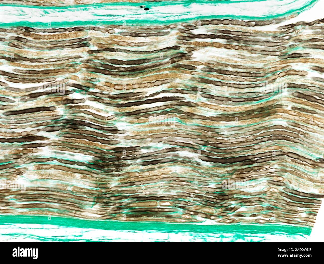 Light microscopy of myelinated nerves in a nerve fibre. Axons appear as ...