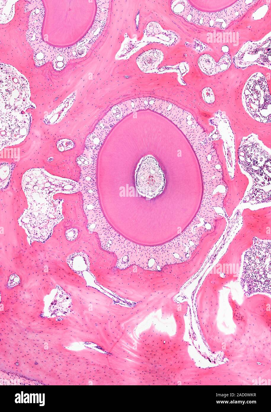 Light microscopy of a tooth. This section is below the gumline and ...
